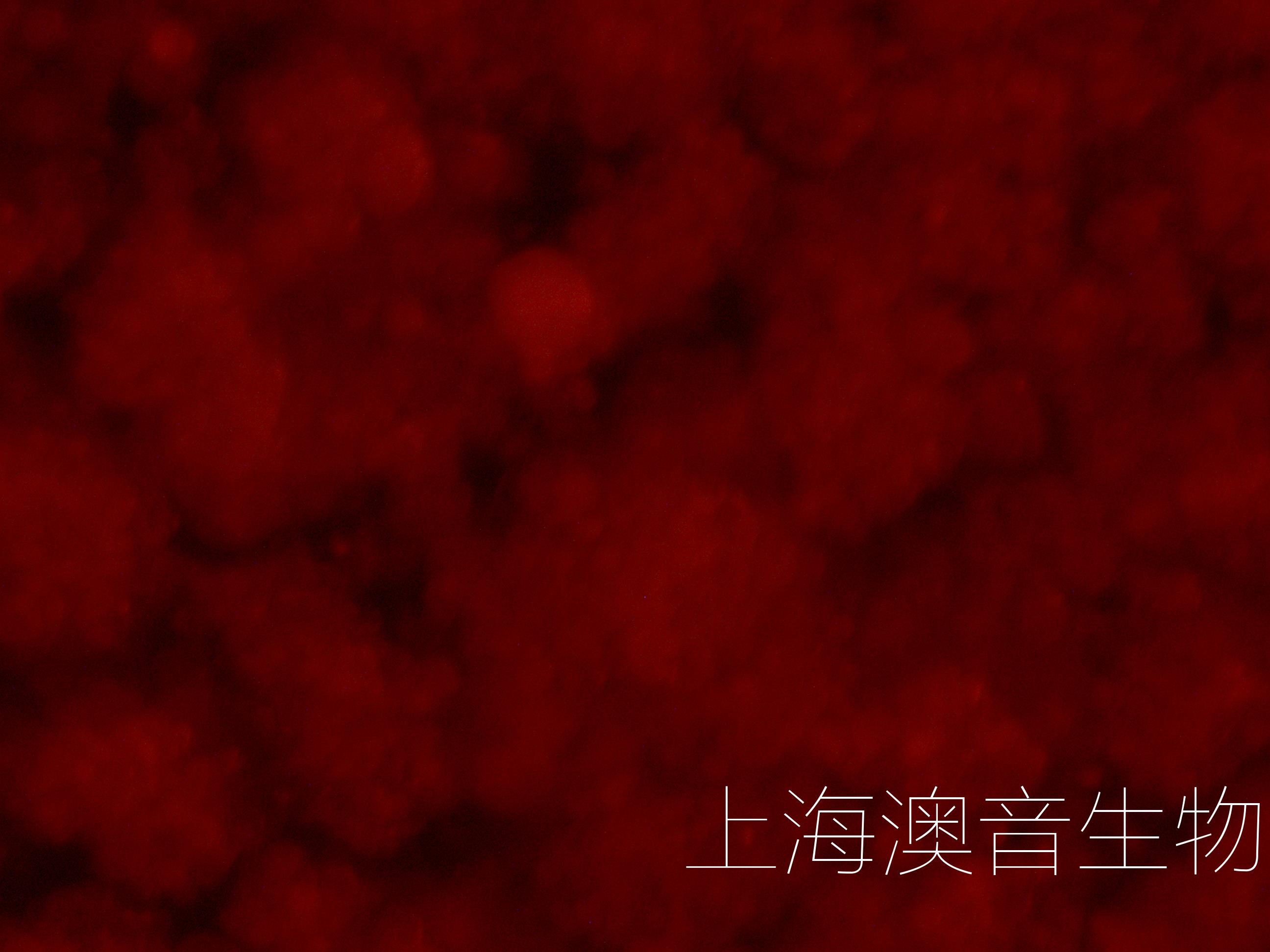 Jurkat-LUC-RFP双标记的人T淋巴细胞白血病细胞-企业官网