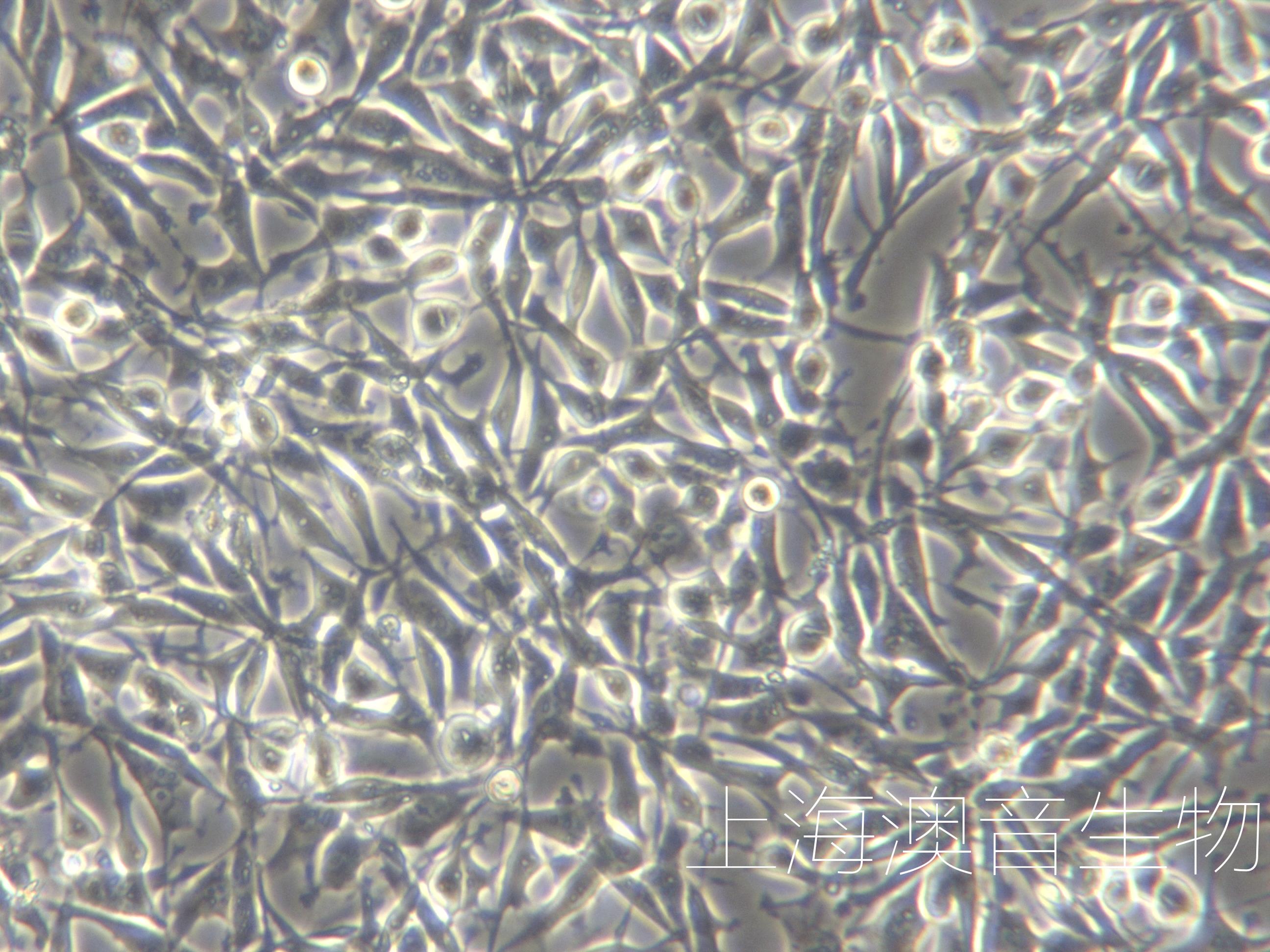 ES-2人卵巢透明细胞癌-企业官网
