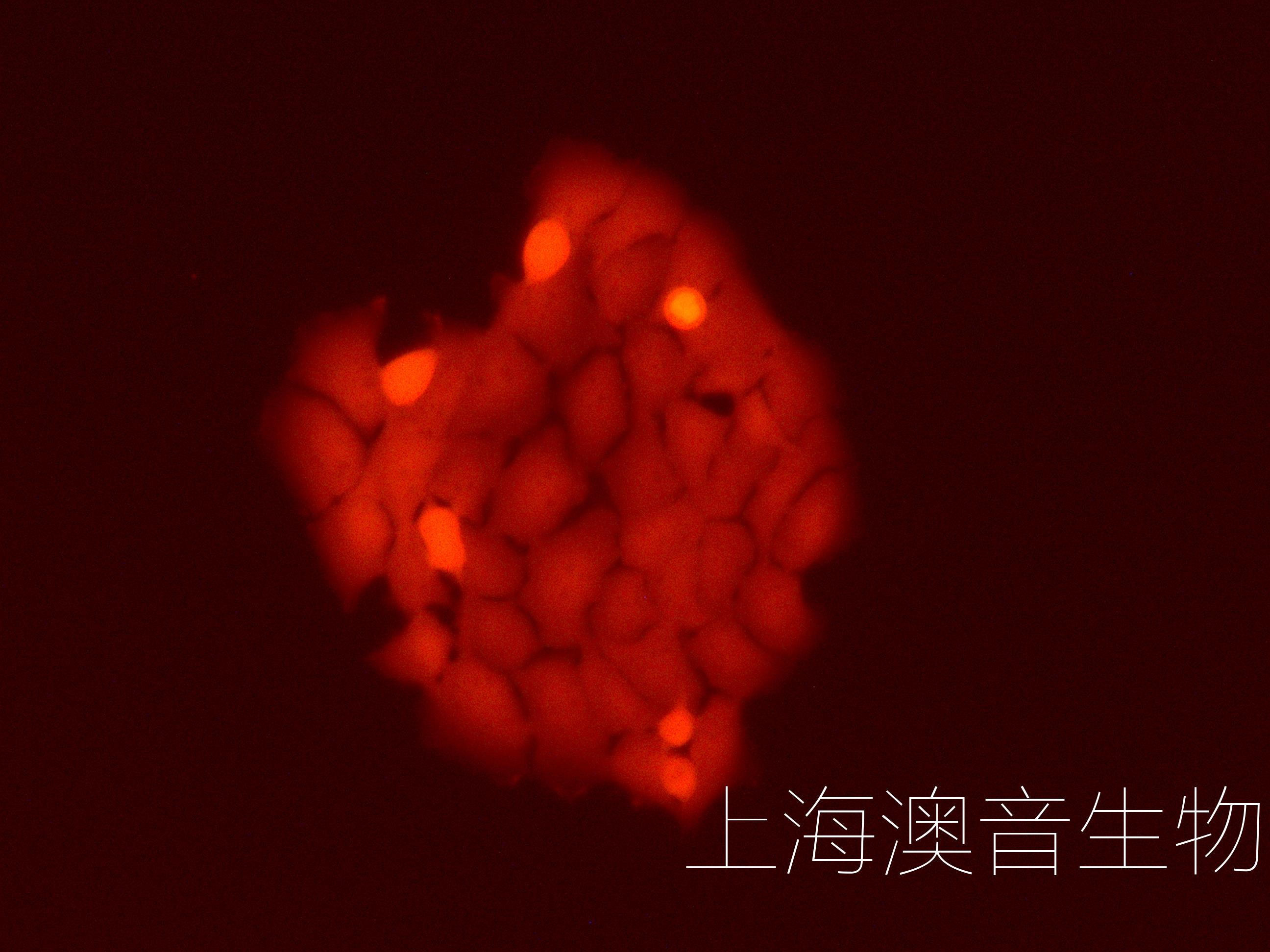 143B-LUC-RFP-Puro-CLONE双标记的人骨肉瘤细胞（胸腺激酶缺陷细胞） -企业官网