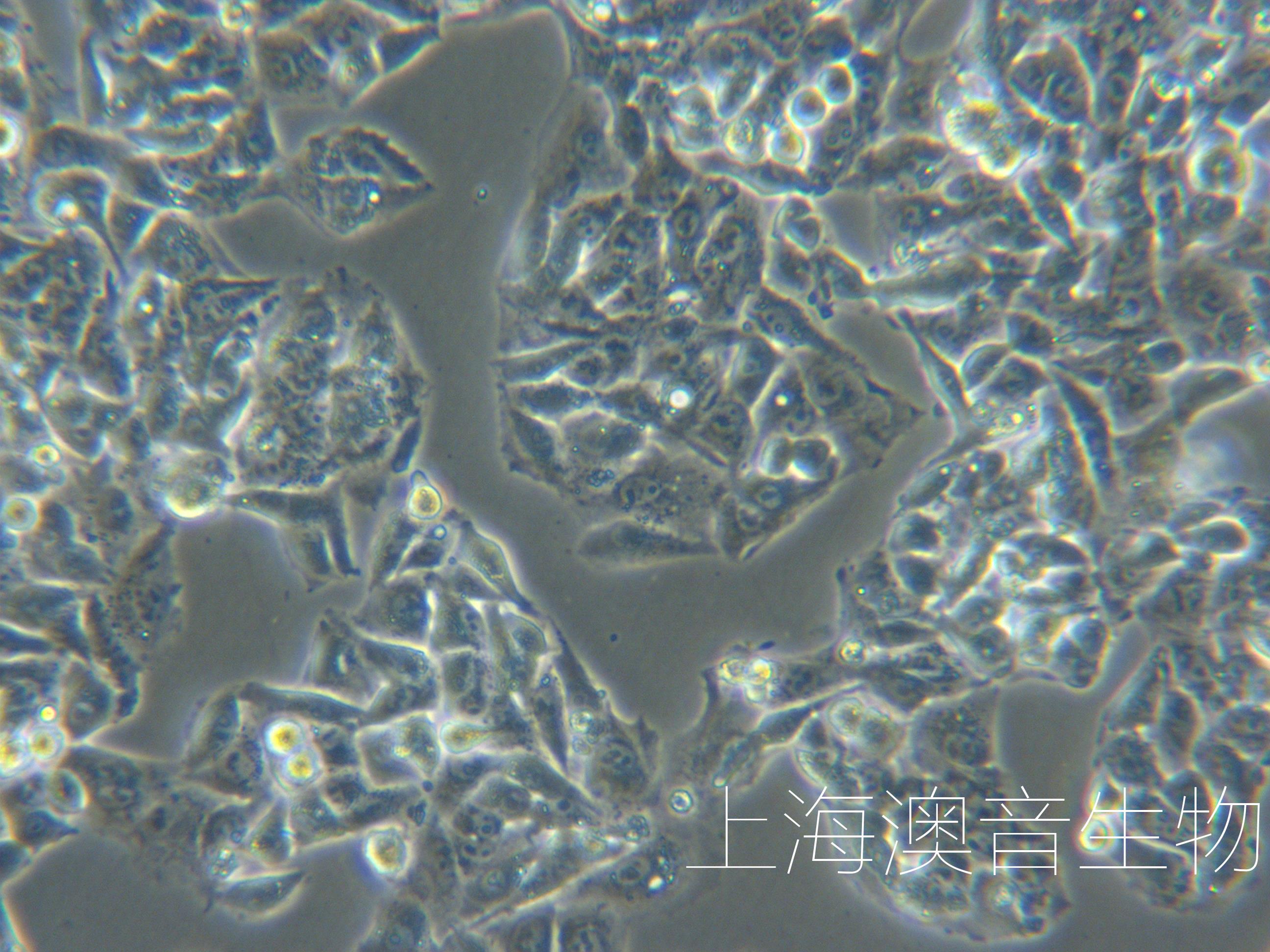 HepAD38人肝癌细胞-企业官网