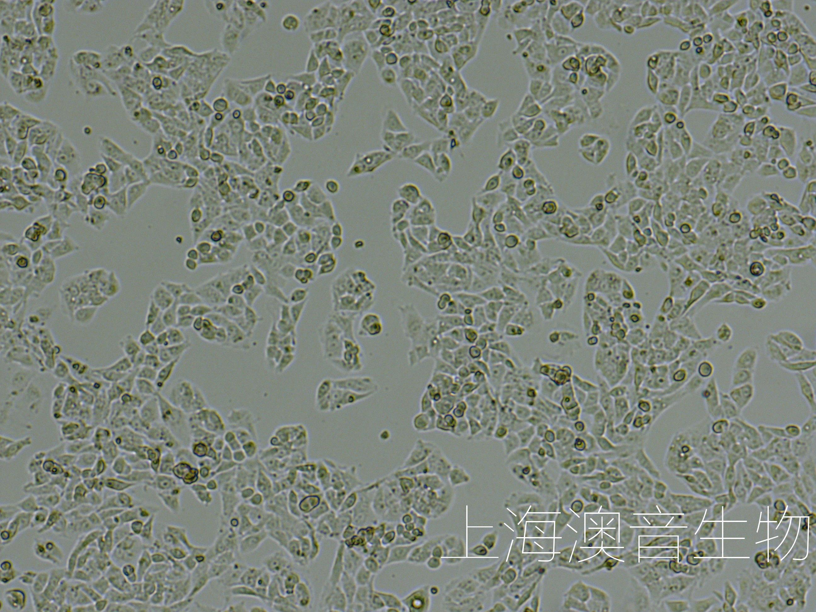 HepAD38人肝癌细胞-企业官网
