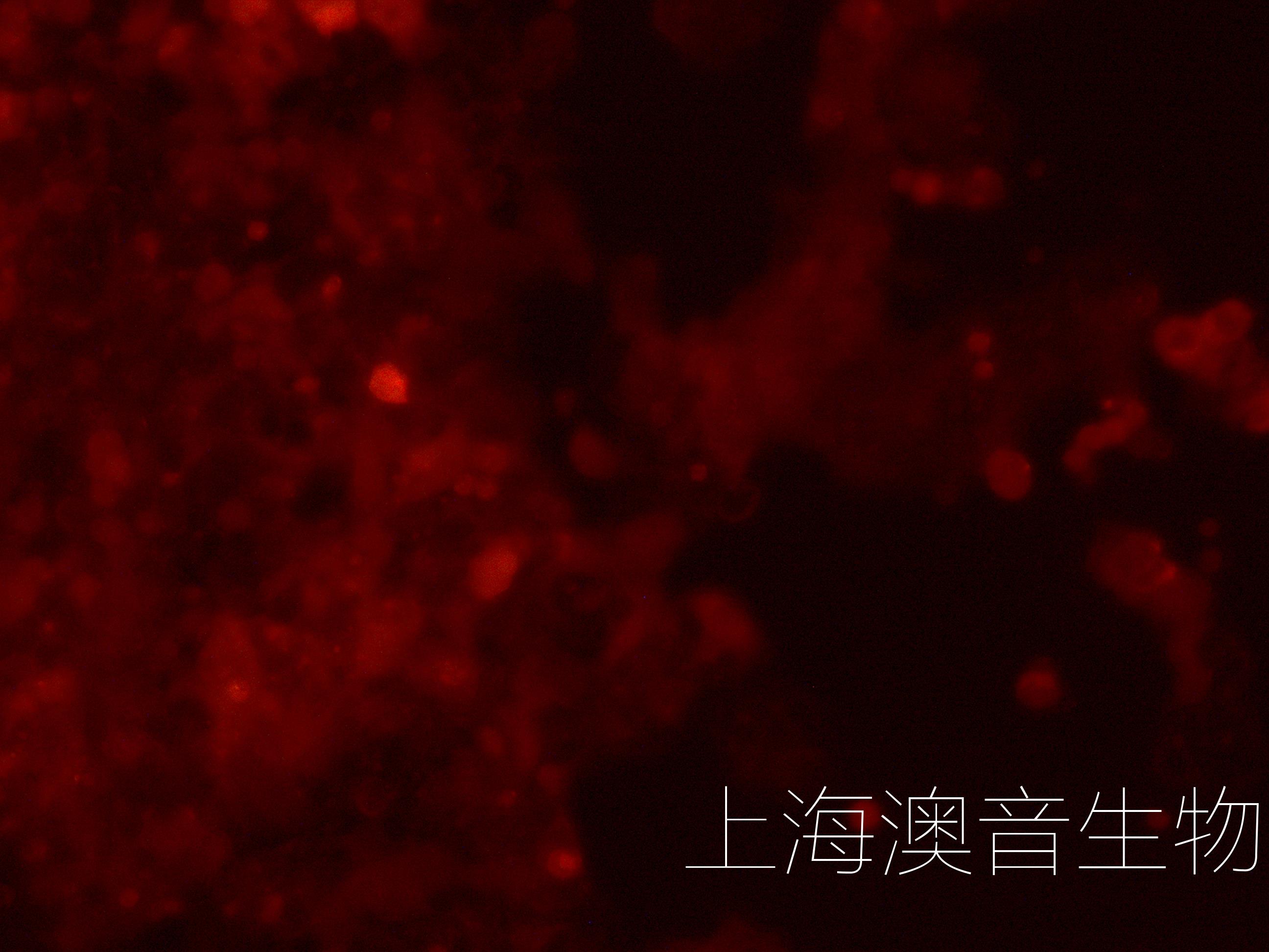 LoVo-LUC-RFP-Puro双标记的人结直肠癌细胞-企业官网