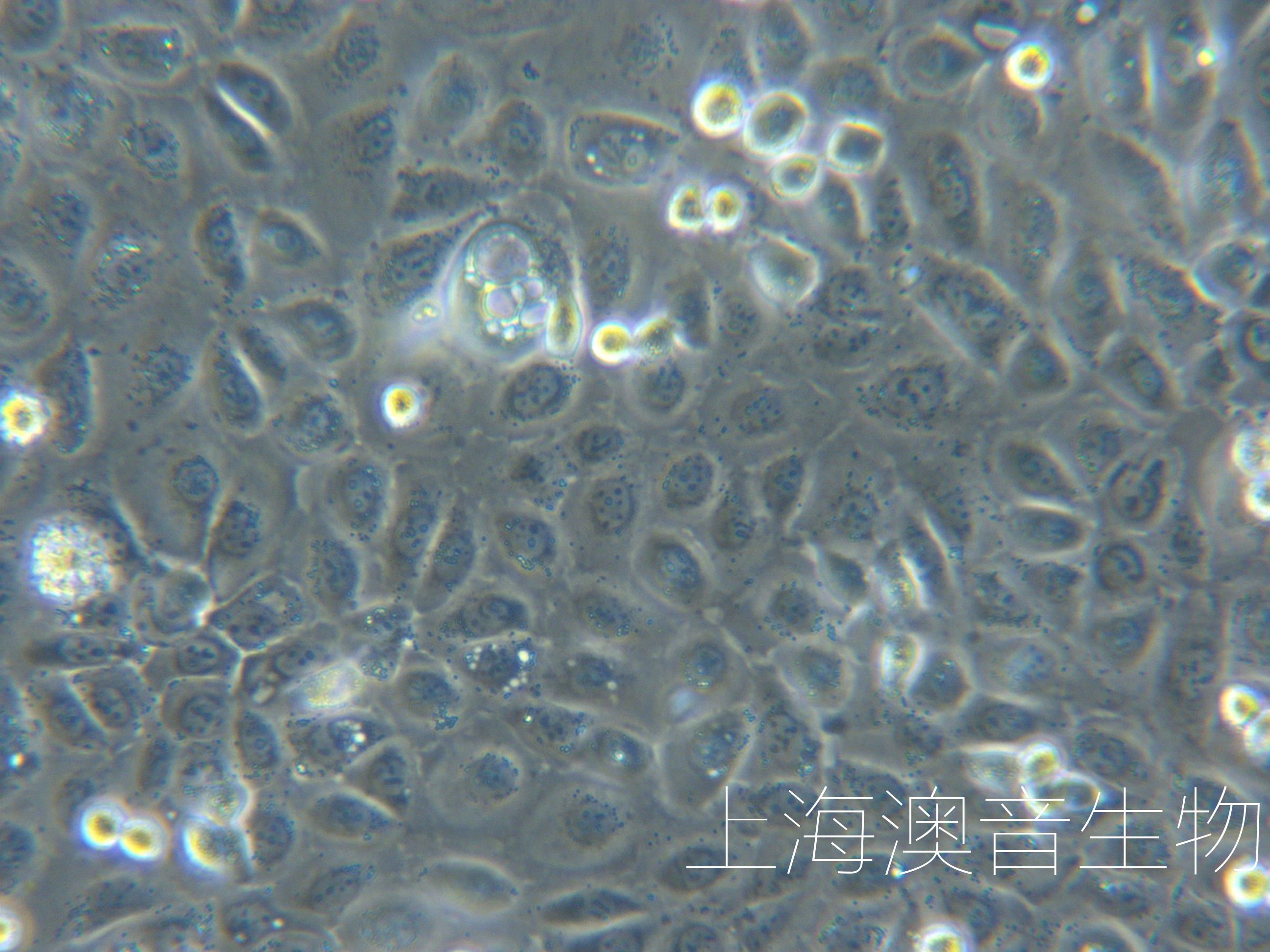 SCC-25人口腔鳞癌细胞-企业官网