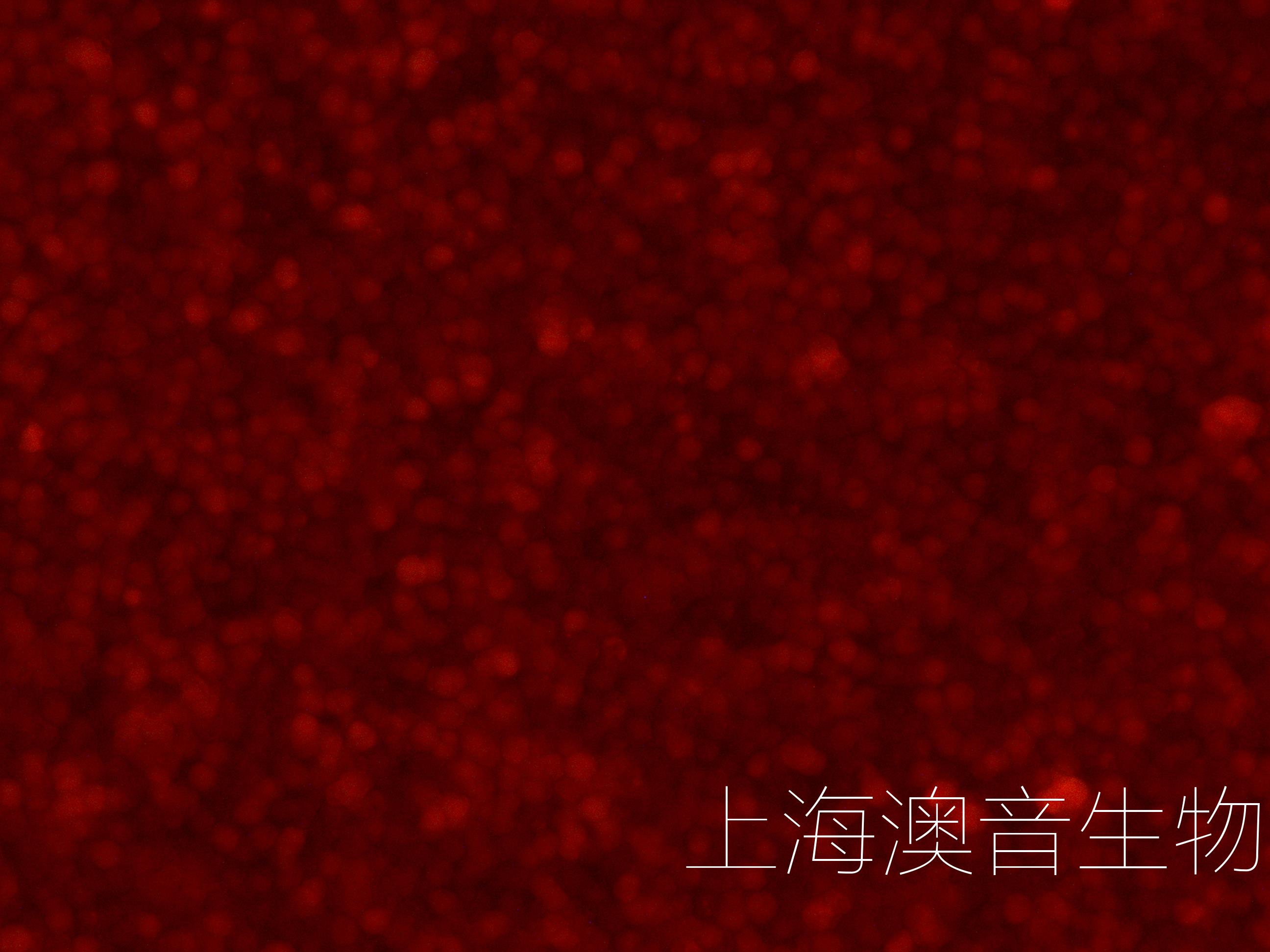 Daudi-LUC-RFP-Puro双标记的人Burkitt's淋巴瘤细胞-企业官网