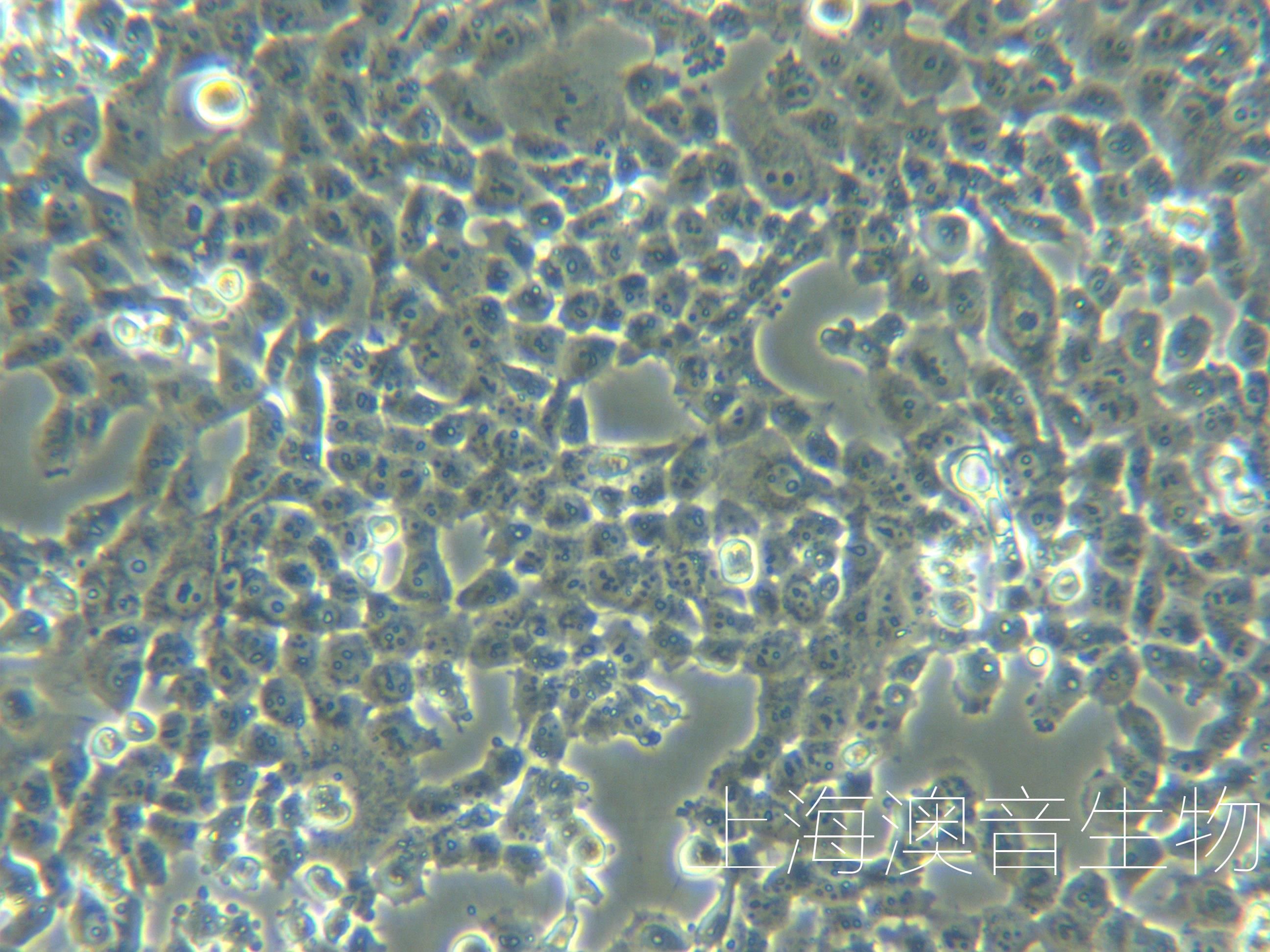 IOMM-Lee人脑膜瘤细胞-企业官网