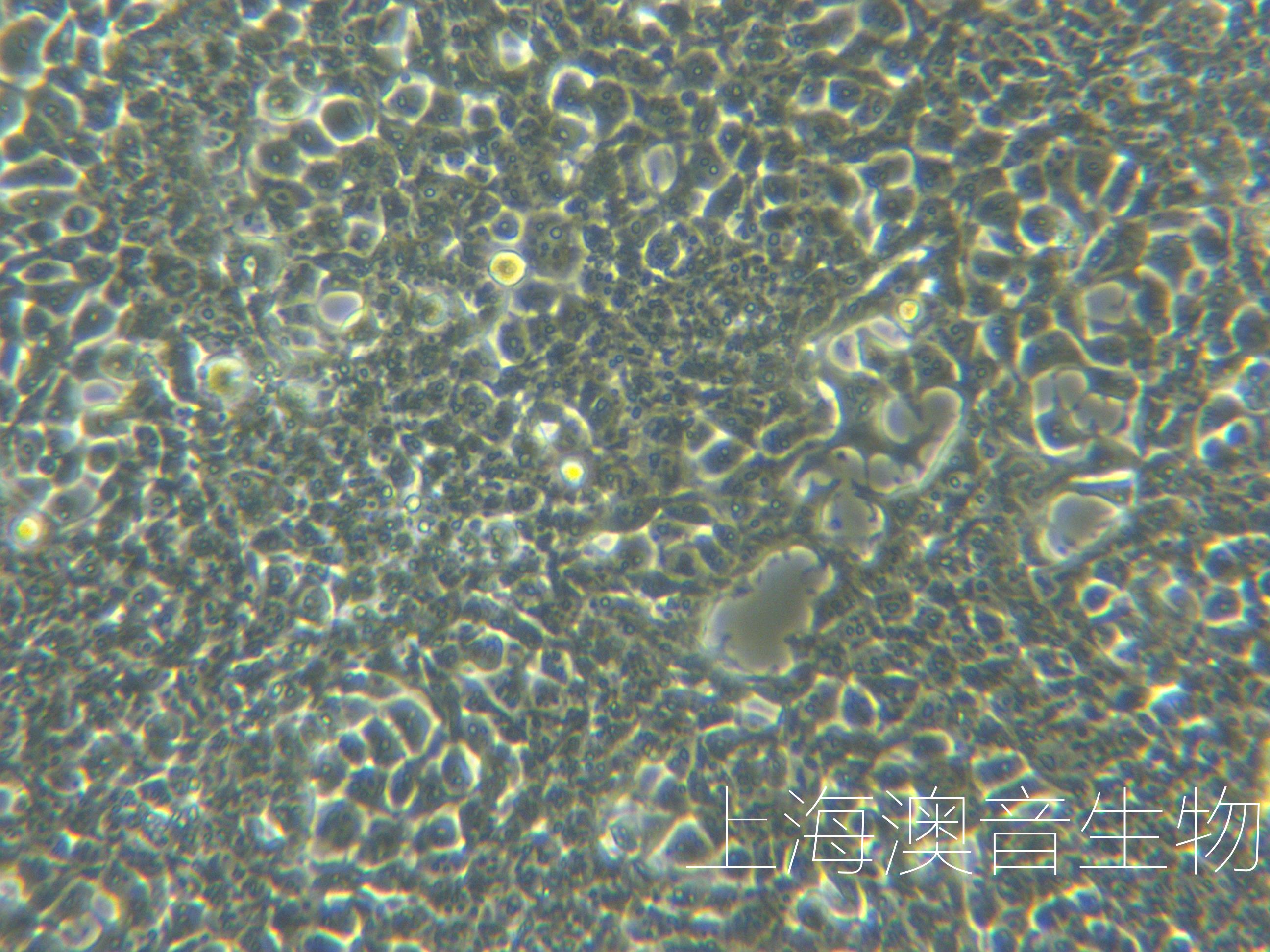 Plat-e人逆转录病毒包装细胞-企业官网