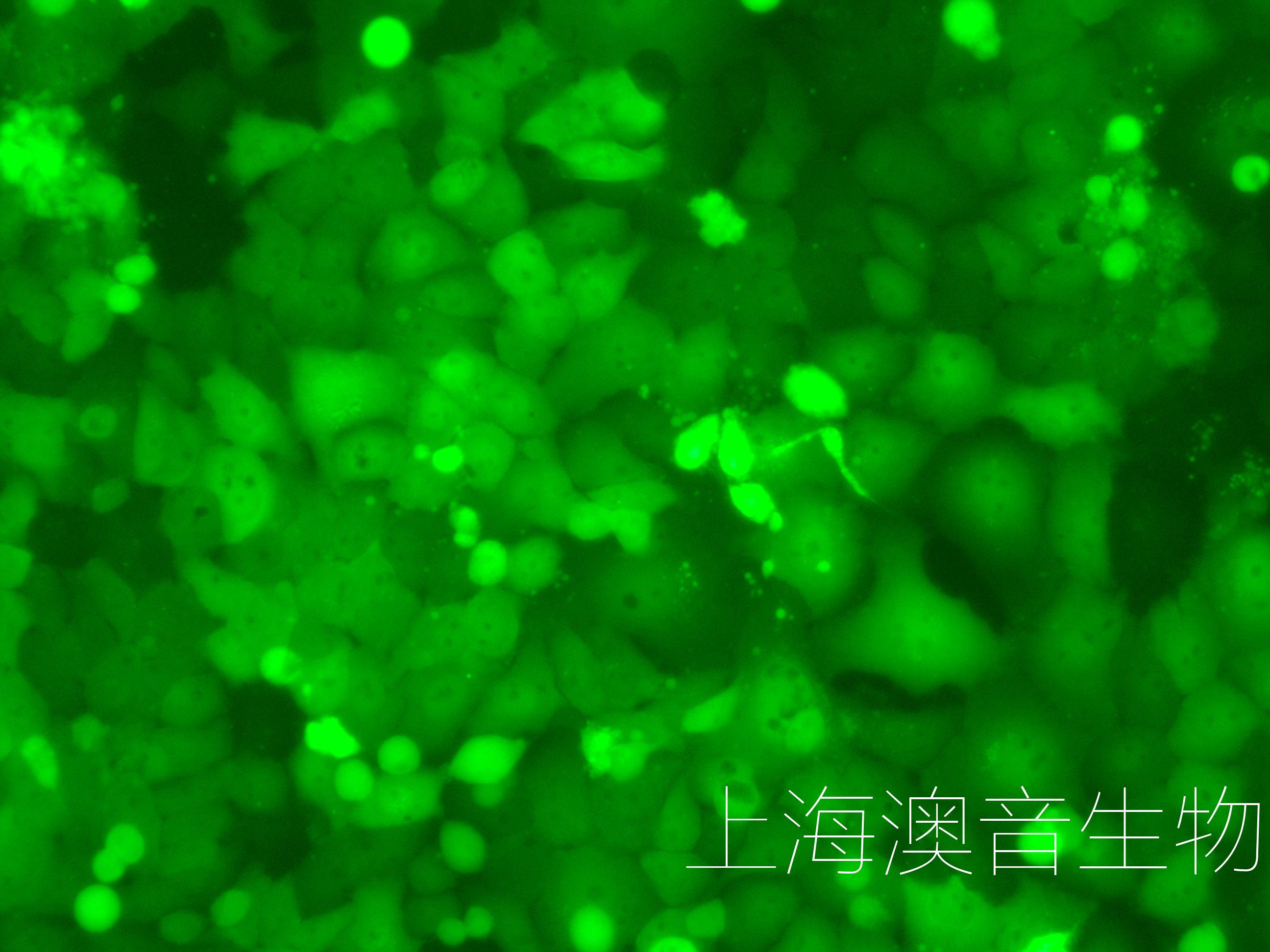 CAL-27-LUC-GFP-Puro双标记的人舌鳞状细胞癌细胞-企业官网