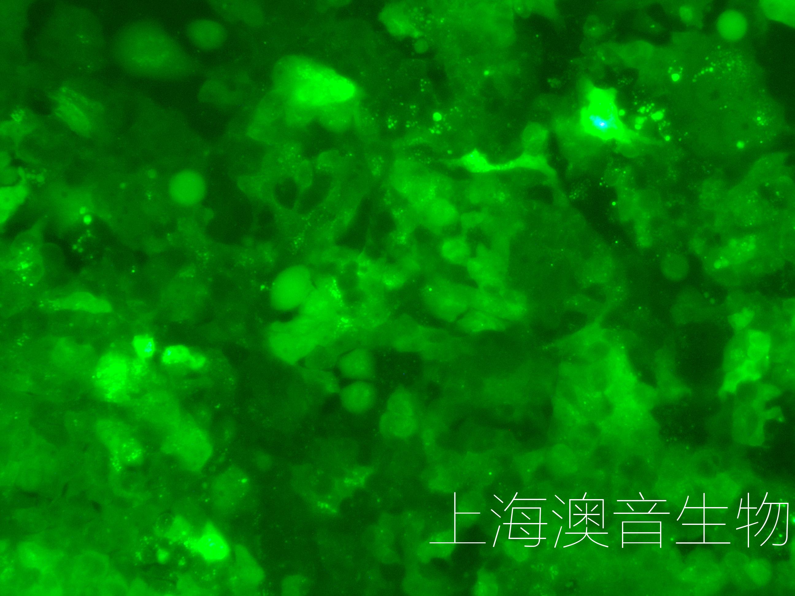 OV-90-LUC-GFP-Puro双标记的人卵巢癌细胞-企业官网