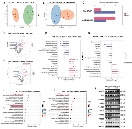 Metabolism-Clinical and Experimental：秦彦文团队揭示关键酶ACO1重塑代谢流向，破局高胆固醇血症治疗-中科脂典